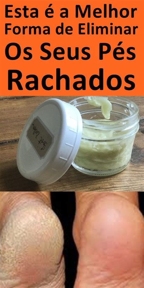 Receita Caseira Para Eliminar Pés Rachados Passo a Passo Receitas