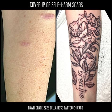 Update More Than Forearm Scar Cover Up Tattoos Super Hot In Cdgdbentre