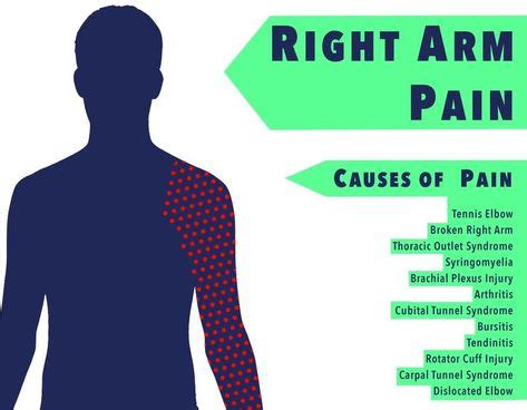 Arm Pain Diagnosis Chart