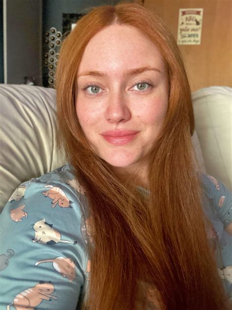 I Love My Freckles💋💋 Rsexyfrex