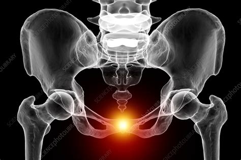 Symphysis Pubis Dysfunction Illustration Stock Image F