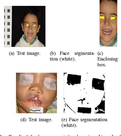 figure 1 from visual lip segmentation in patients with cleft lip and or cleft palate semantic