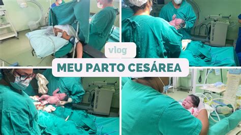 Vlog Meu Parto Ces Rea Minha Filha Estava Acima Do Peso Precisei