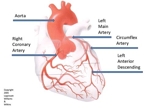 Coronary Angiography HeartWest