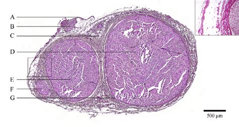 Peripheral Nerve Histology Cross Section
