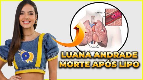 LUANA ANDRADE O QUE CAUSOU A MORTE DA INFLUENCIADORA YouTube