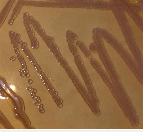 Pseudomonas Aeruginosa Colony Morphology On MacConkey Agar Isolated