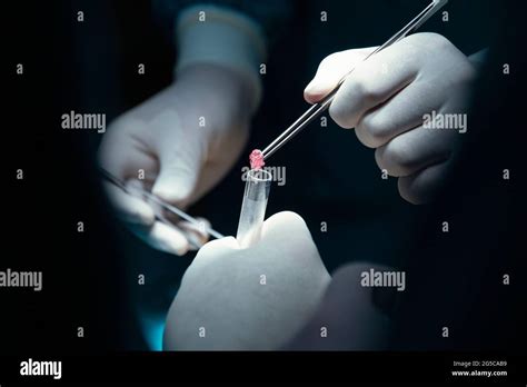 Krebs im krankenhaus Fotos und Bildmaterial in hoher Auflösung Alamy