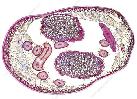 Ascaris Lumbricoides Male And Female Cross Section