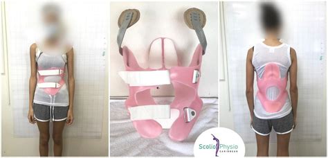 Kyphologic Brace Scolio Physio Caribbean