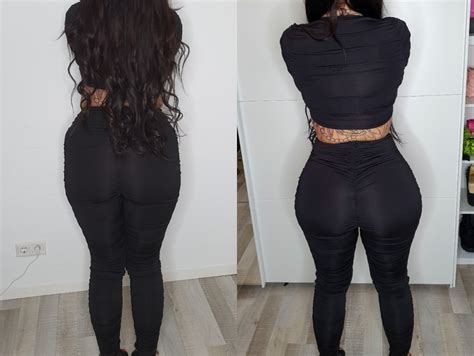 Before And After Brazilian Butt Lift Fablasopa