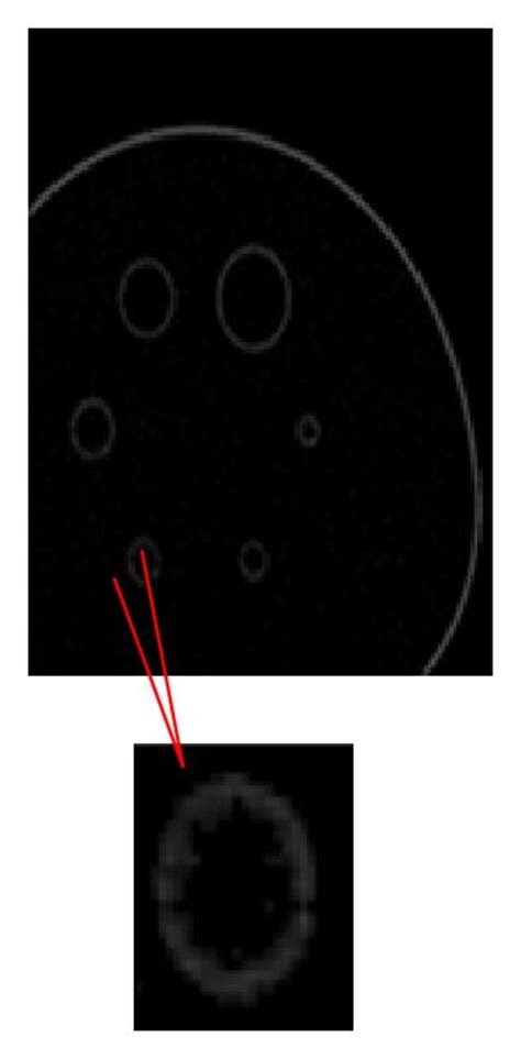 segmentation using conventional hard thresholding and curvelet based download scientific