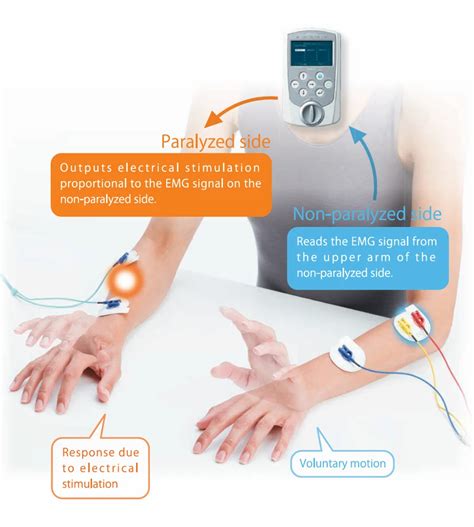 Handheld Functional Electrical Stimulator FES Model Name Number GD
