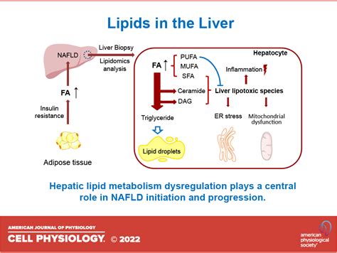 Role Of Hepatic Lipid Species In The Progression Of Nonalcoholic Fatty