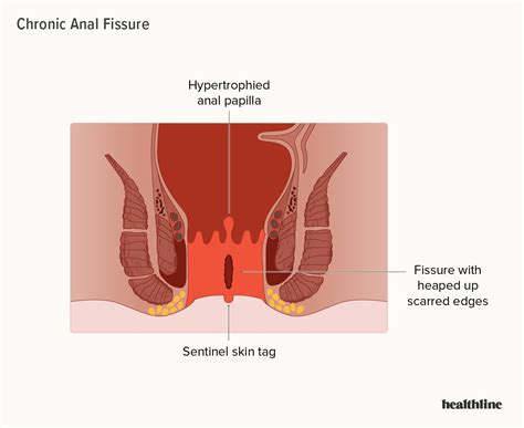Anal Best Adult Videos And Photos