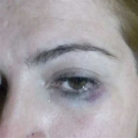 La mujer que denunció a los rugbiers franceses difundió fotos de las