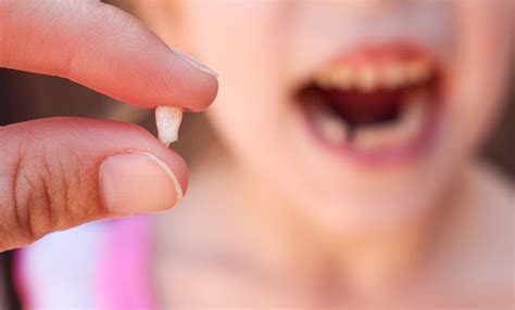 Mi hijo se ha roto un diente qué hago Doctores Piña Goyenechea
