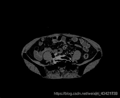 python vtk三维重建ct image j 三维重建 mob64ca1403c772的技术博客 51cto博客