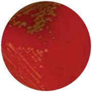 Hemólisis Alfa En Agar Sangre