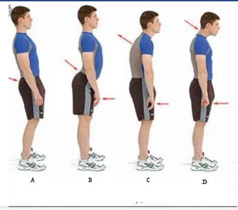 Low Back Pain Flashcards Quizlet