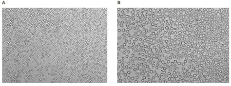 Hematopoietic Stem Cell Culture Methods