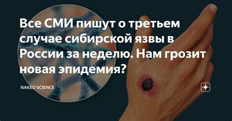 Все СМИ пишут о третьем случае сибирской язвы в России за неделю Нам
