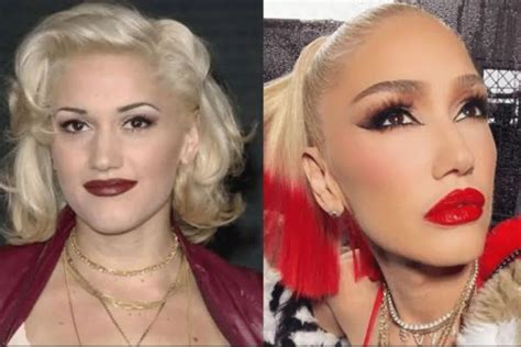 Did Gwen Stefani Get Lips Surgery Before And After Photo