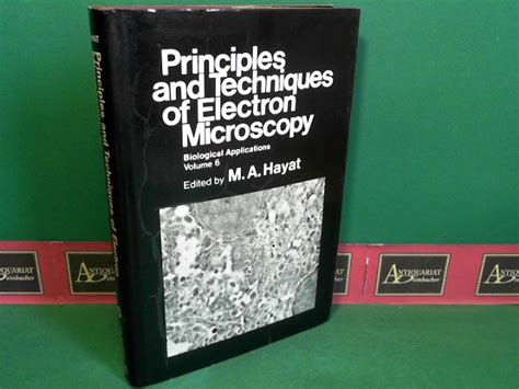 Principles And Techniques Of Electron Microscopy Biological