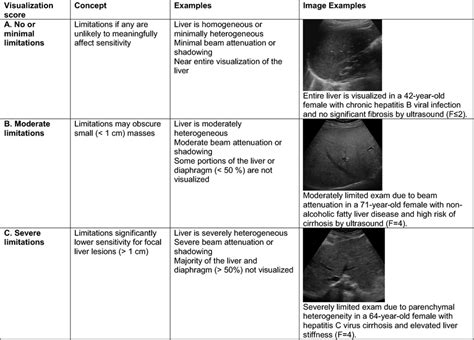 Of American College Of Radiology Ultrasound Liver Imaging—reporting And Download Scientific