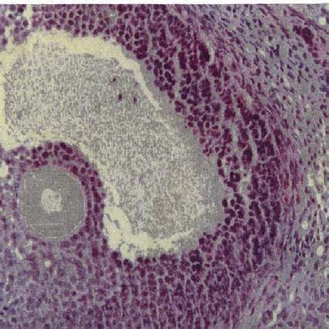 In The Mature Or Graafian Follicle Of The Ovary Telegraph