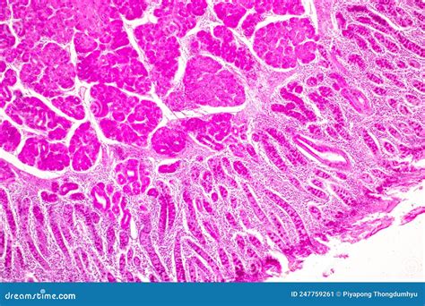 Small Intestine Duodenum And Vermiform Appendix Human Under The