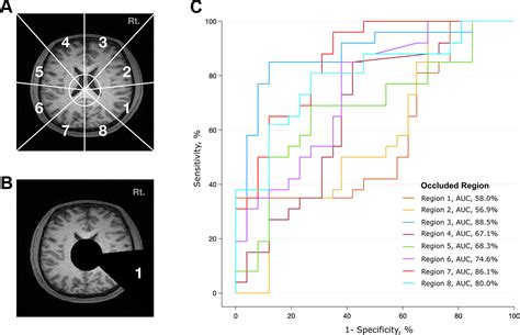 frontiers identifying schizophrenia using structural mri with a deep learning algorithm