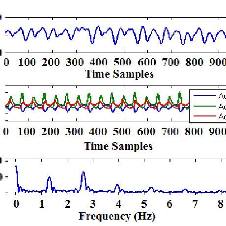 PDF Motion Artifact Reduction From PPG Signals During Intense