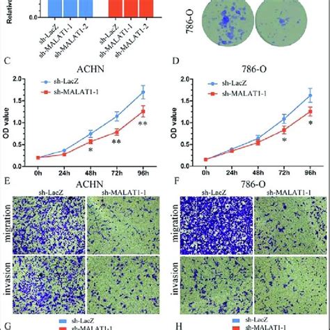 Knockdown Of MALAT1 Inhibited Cell Proliferation And Metastasis In