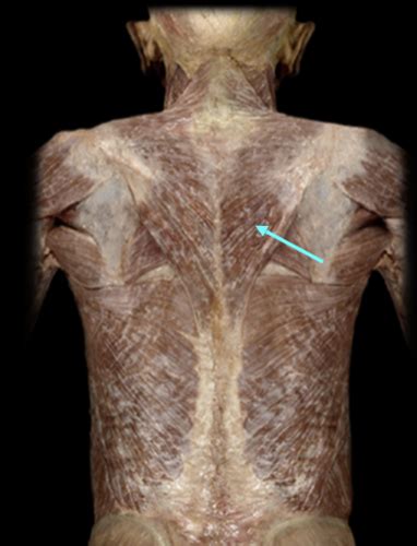 Axial Muscles Torso Flashcards Quizlet