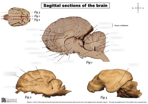 Sagittal Sections Of The Brain Diagram Quizlet