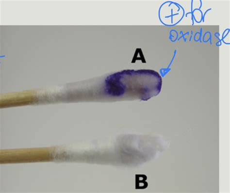 Microbiology Lab Midterm Flashcards Quizlet
