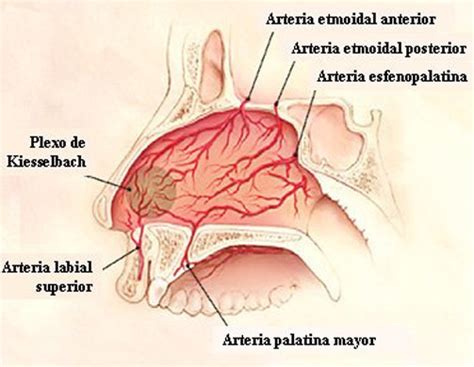Epistaxis GAES ORL GUIDE