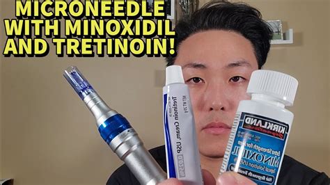 HOW TO MICRONEEDLE WITH MINOXIDIL AND TRETINOIN FOR MAXIMUM HAIR GROWTH