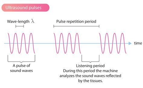 Sound Waves Physics Definition