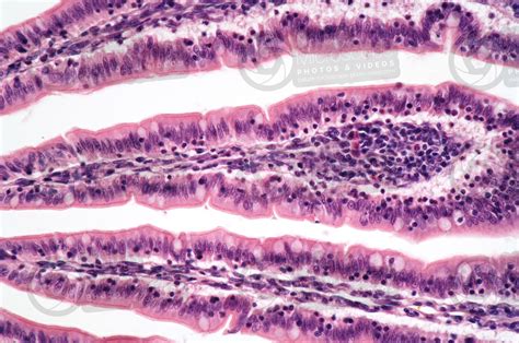 Rat Small Intestine Transverse Section 250X Rat Mammals