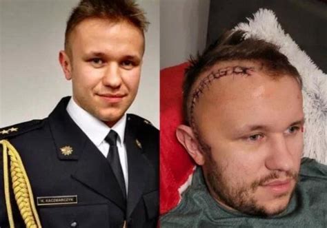 Letni Stra Ak Walczy O Ycie Pojawi Si On Glejak M Zgu Kamila