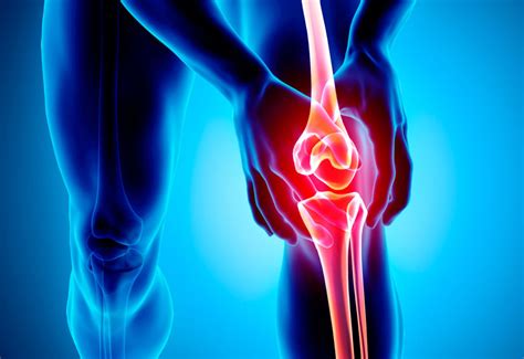 Tendinitis de la Pata de Ganso Síntomas Causas Tratamiento y