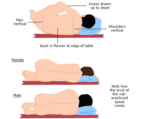 Anatomical Position Definitions And Illustrations Atelier Yuwa Ciao Jp