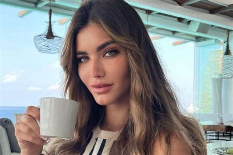 Noticias De Genesis Aleska Alopecia Noticias Fotos Chismes