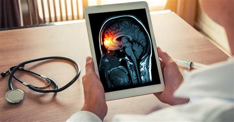 Zapalenie opon mózgowych rodzaje objawy diagnostyka leczenie