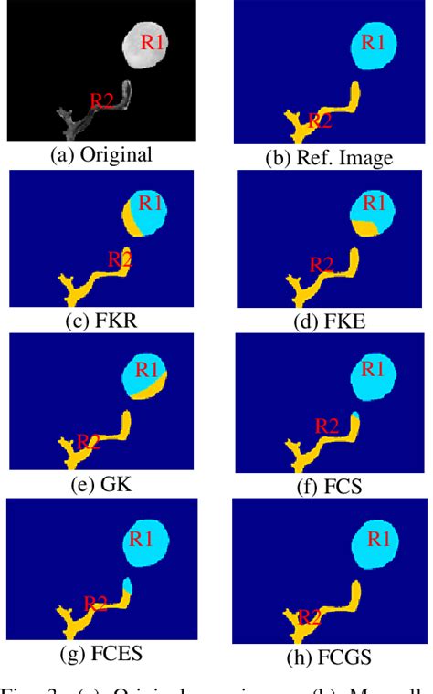 figure 3 from fuzzy clustering for image segmentation using generic shape information semantic
