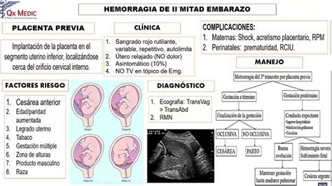 Hemorragia Ii Mitad Del Embarazo Fer Esp Cu Udocz