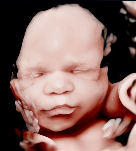 Ultrassonografia 3D 4D E 5D Ultra Realismo MedFem