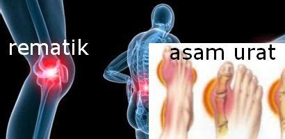 Cara Mengatasi Asam Urat Dan Rematik Health Fitness Herbalism Health
